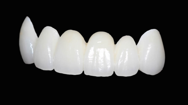 Dental Zirconia Material: Types, Benefits, Applications
