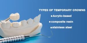 Temporary Crown Guide: Types, Procedure, Materials & Cost